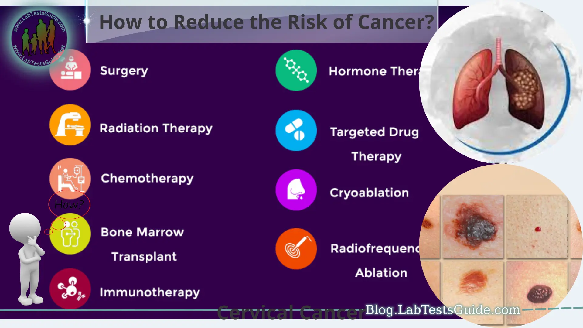 How to Reduce the Risk of Cancer? - Lab Tests Guide Blog
