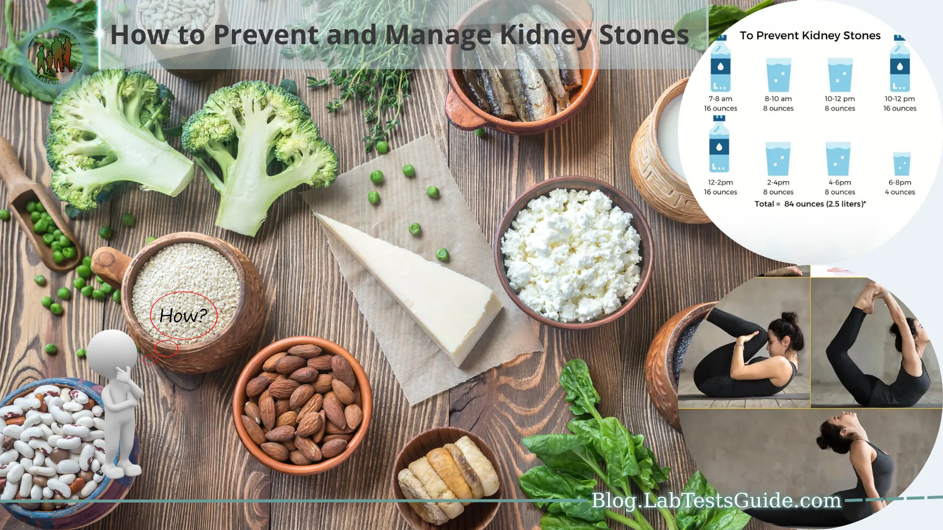 How to Prevent and Manage Kidney Stones - Lab Tests Guide Blog